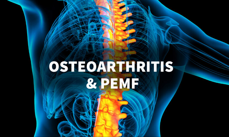 PEMF Therapy: A Non-Surgical Approach to Treating Joint Pain ...